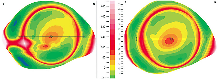 Contact Lens Spectrum | PentaVision