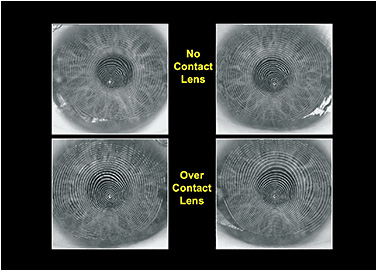Contact Lens Spectrum | PentaVision