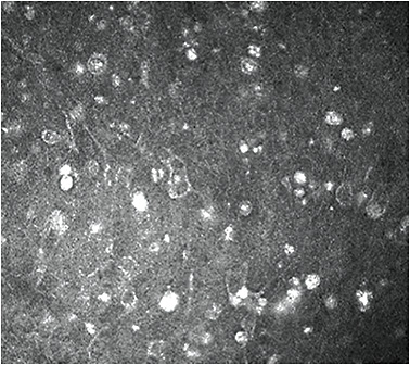Contact Lens Spectrum | PentaVision